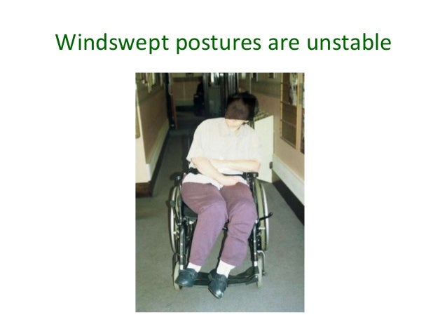 Helping people with MS cope with ataxia