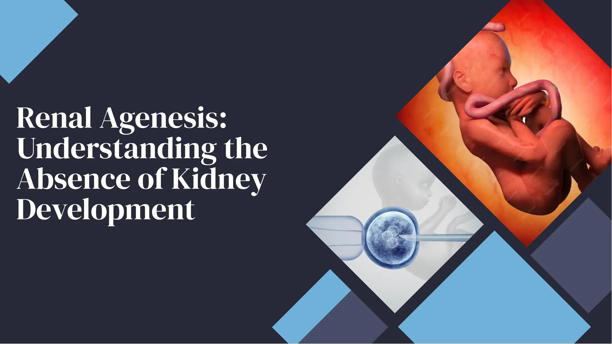 wepik-2023-9-2-20-58-54-Renal-Agenesis:-Understanding-the-Absence-of ...