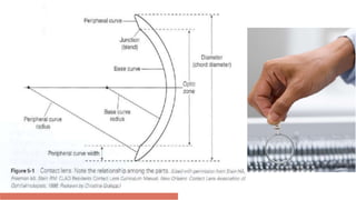 Parameters and finalization of contact lenses | PPTX