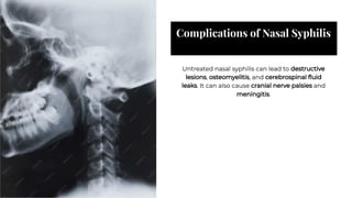 wepik-the-silent-intruder-nasal-syphilis-and-paranasal-sinuses ...