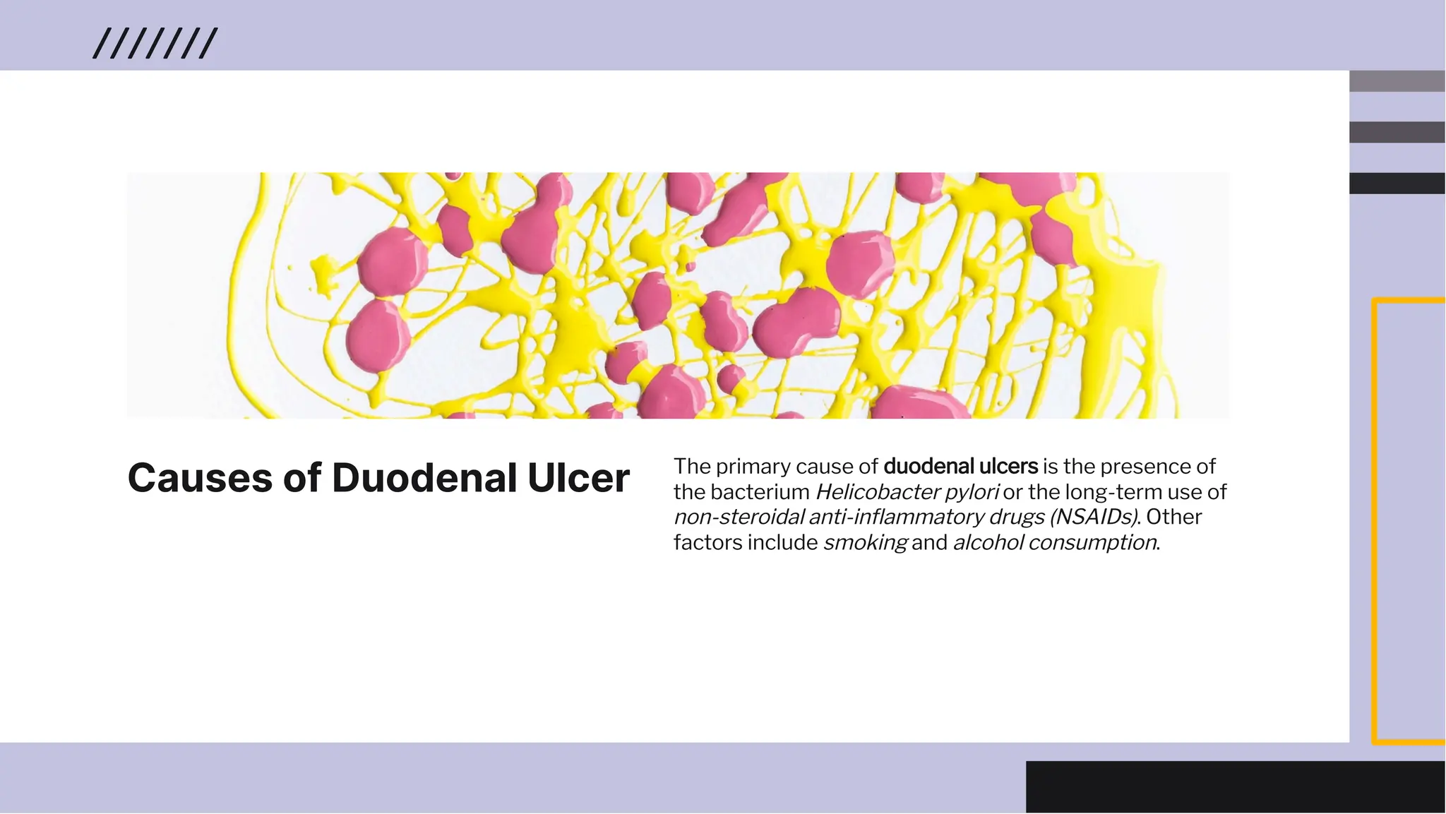 Understanding-duodenal-ulcer-causes-symptoms-and-treatment-options ...