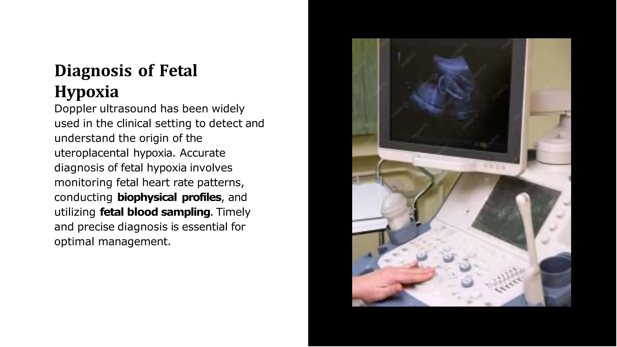 understanding-fetal-hypoxia-a-comprehensive-examination-of ...