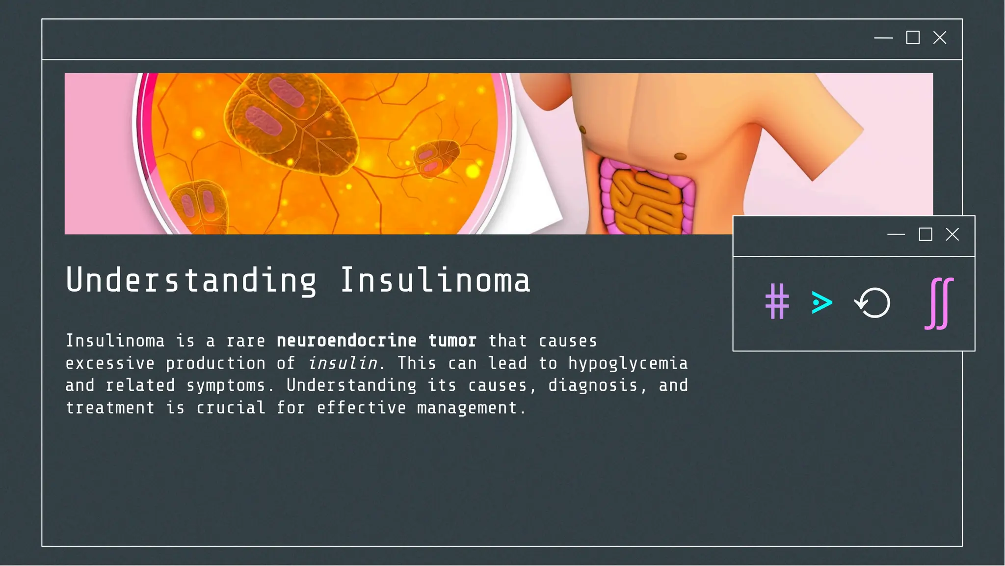 insulinoma-causes-diagnosis and treatment | PDF