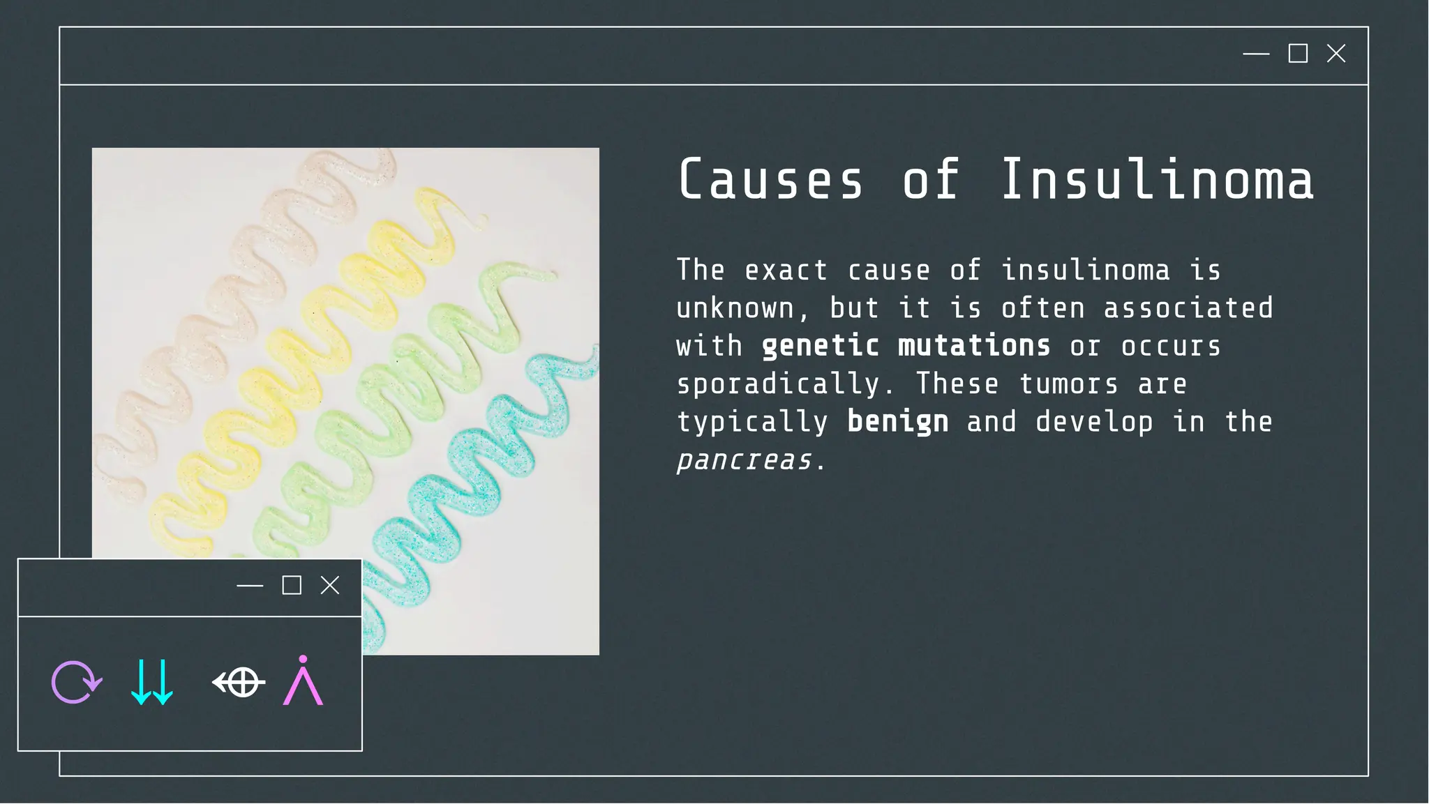 insulinoma-causes-diagnosis and treatment | PDF