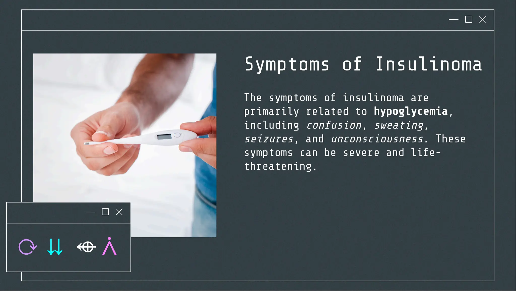 insulinoma-causes-diagnosis and treatment | PDF