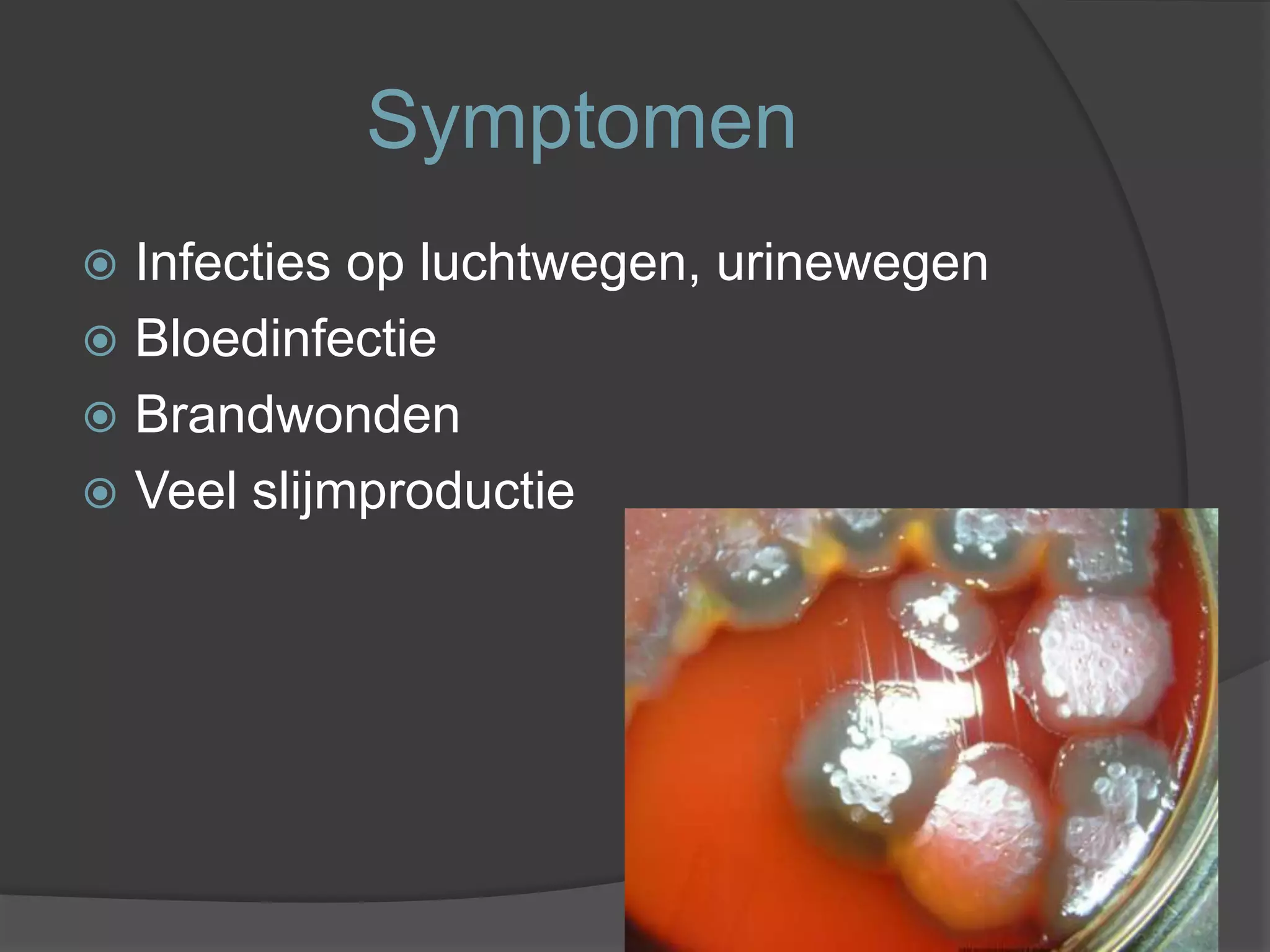 Pseudomonas aeruginosa | PPTX