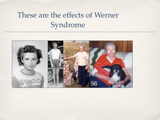 Werner syndrome | KEY