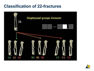 Forearm shaft fractues | PPT