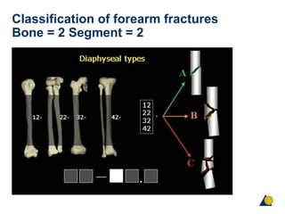 Forearm shaft fractues | PPT