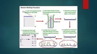 Western blot principles [day1) | PPT