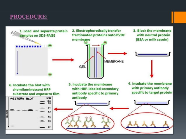 WESTERN BLOTTING.pptx