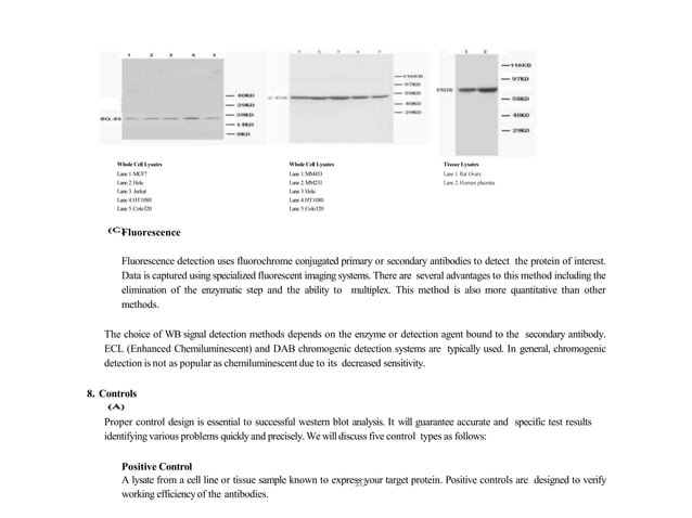 Western blotting principle | PPTX
