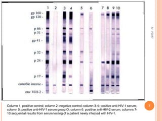Western blotting test | PPTX