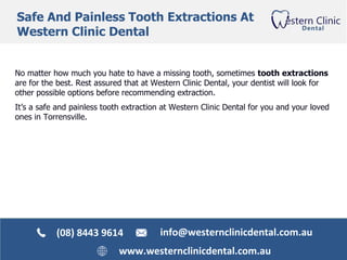 Western Clinic Dental - Tooth Extraction | PPTX