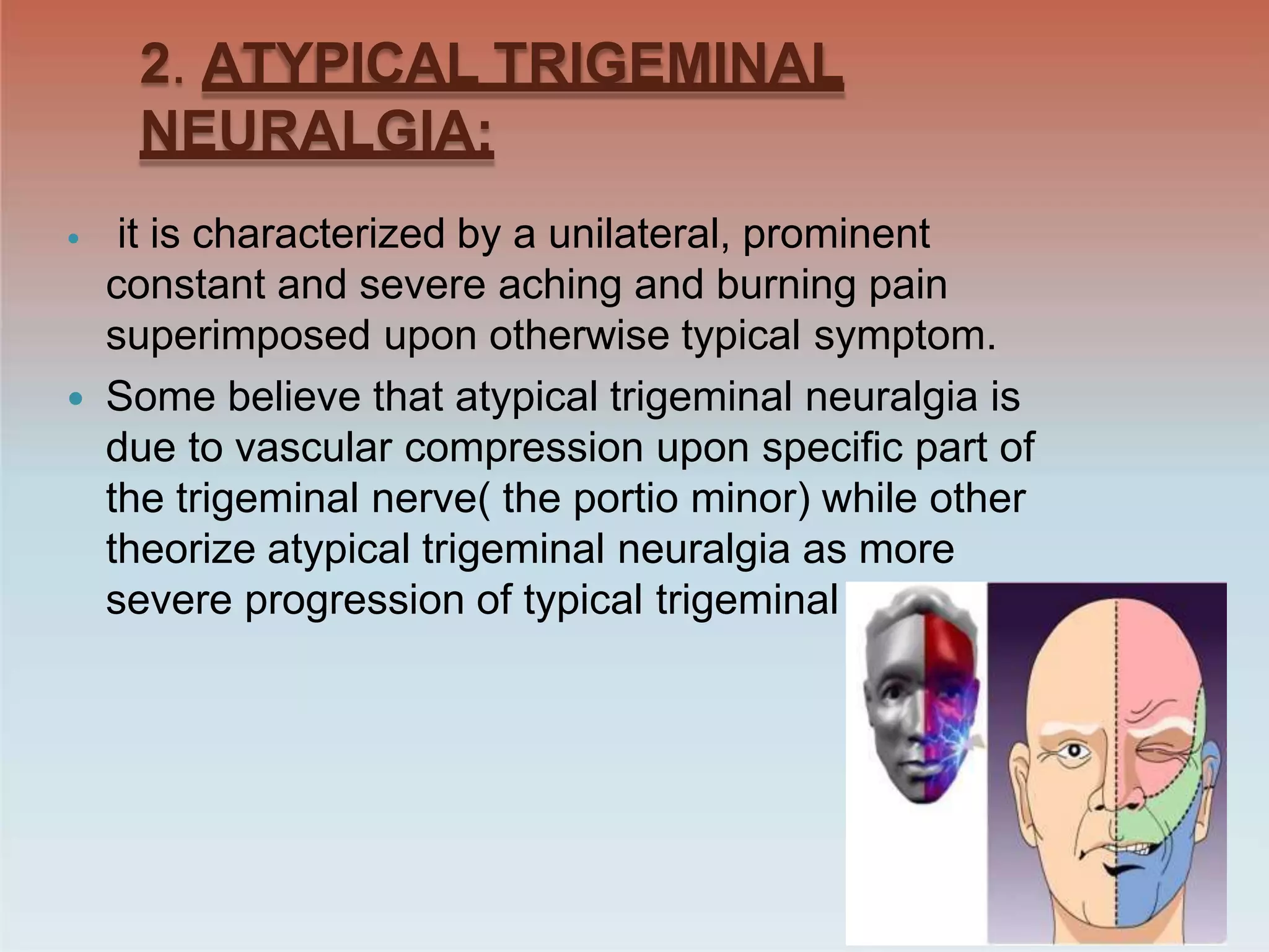 Trigeminal_neuralgia_.pptx