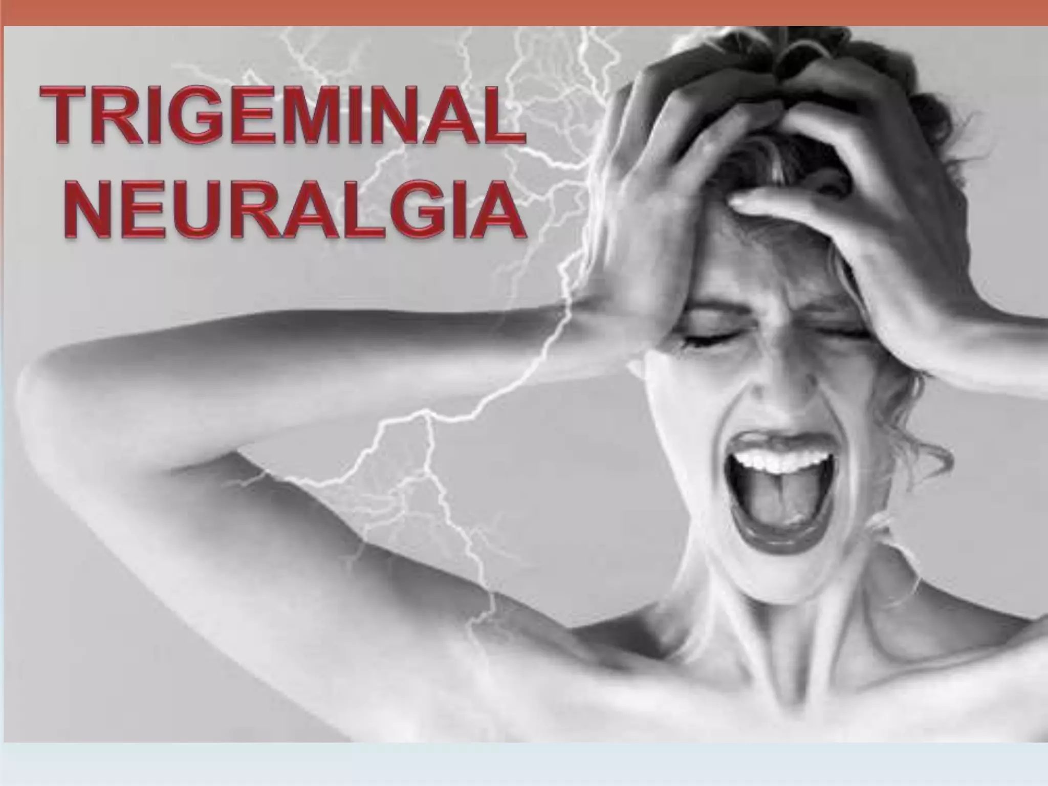 TRIGEMINAL NEURALGIA GUIDE | PPT