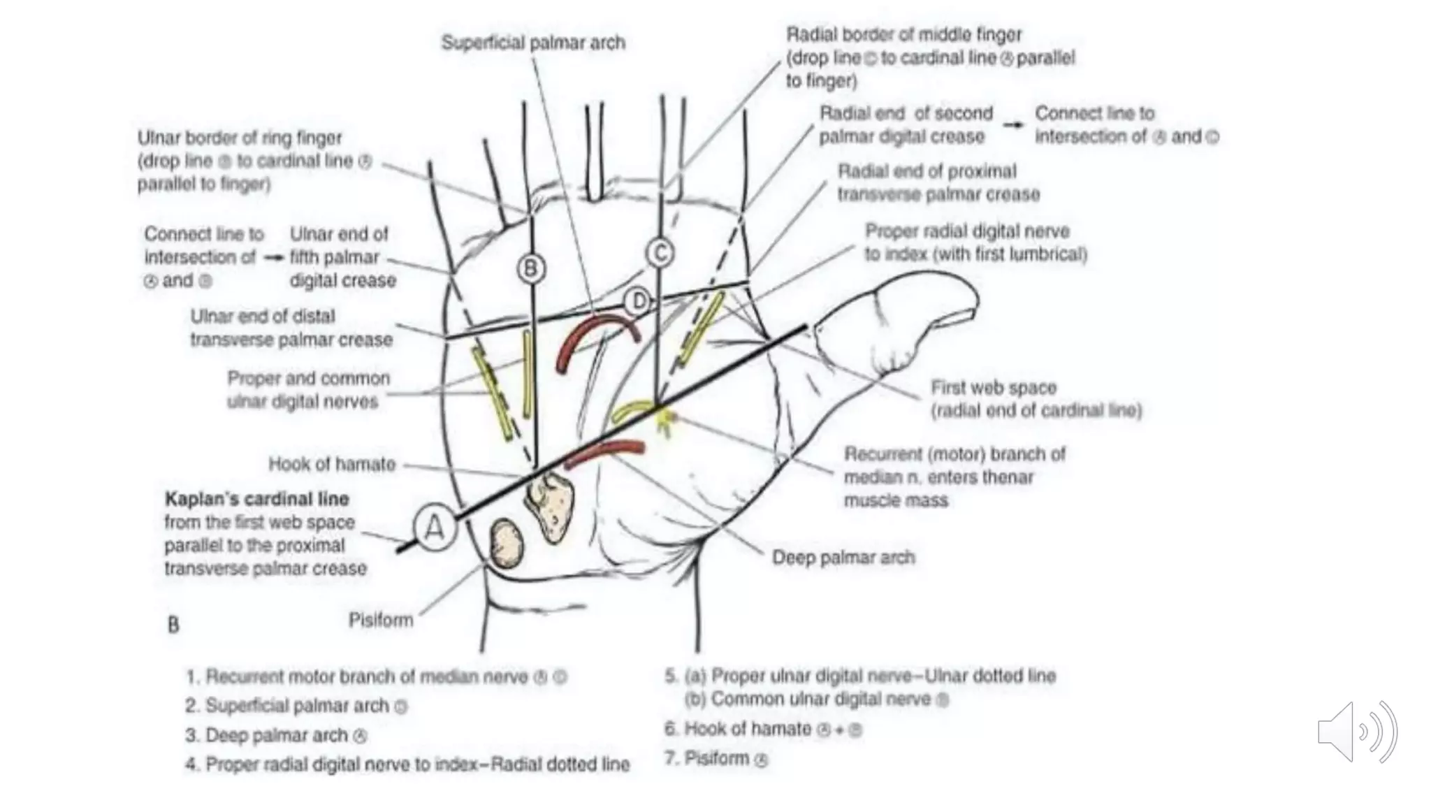 Phenol blocks for spasticity | PPSX