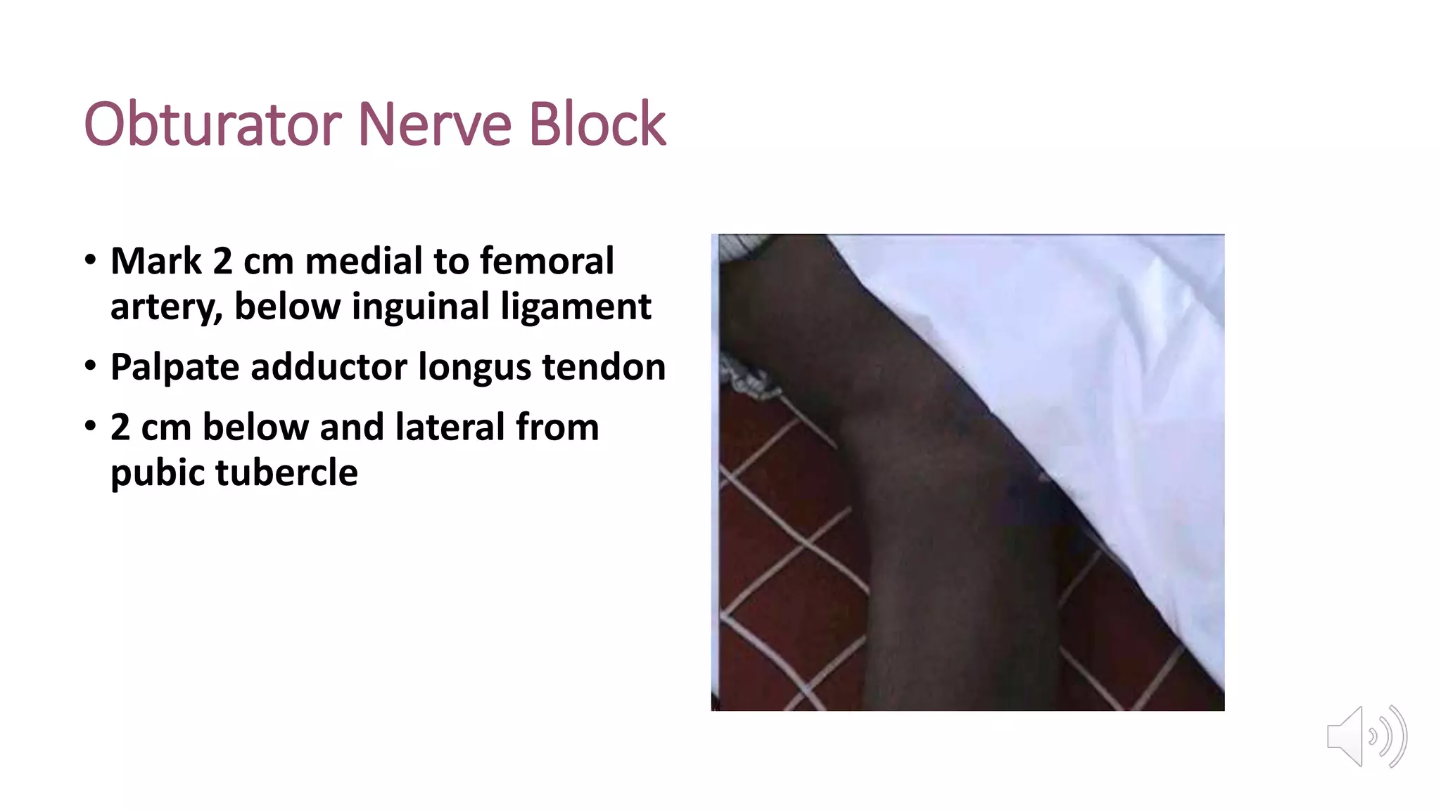Phenol blocks for spasticity | PPSX