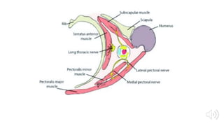 Phenol blocks for spasticity | PPSX