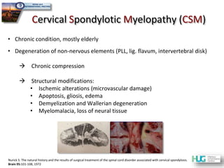 Multidisciplinary approach to patients with cervical myelopathy | PPT