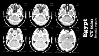 Egypt on the road to achieve SDG-2 "Zero Hunger" | PPT