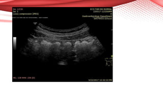 Wfumb slideseries guis normal aspects | PPT