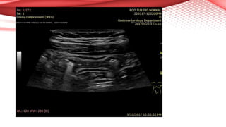 Wfumb slideseries guis normal aspects | PPT