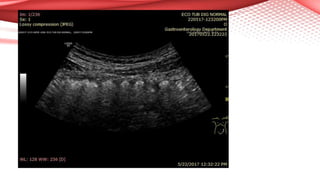 Wfumb slideseries guis normal aspects | PPT