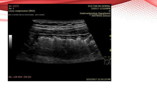 Wfumb slideseries guis normal aspects | PPT