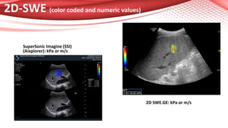 Wfumb slideseries liver elastography | PPTX