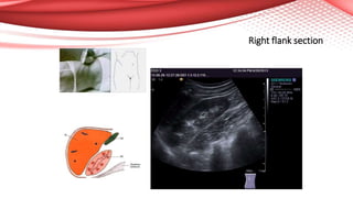Wfumb slideseries the view in the body sonoanatomy | PPTX