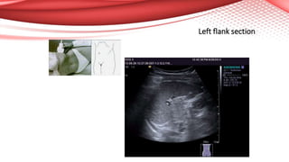 Wfumb slideseries the view in the body sonoanatomy | PPTX