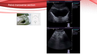 Wfumb slideseries the view in the body sonoanatomy | PPTX