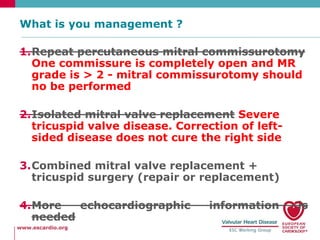When to perform Tricuspid valve Surgery? | PPTX
