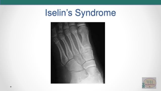 Apophyseal Injuries:vGrowth Related Musculoskeletal Issues - Westches…