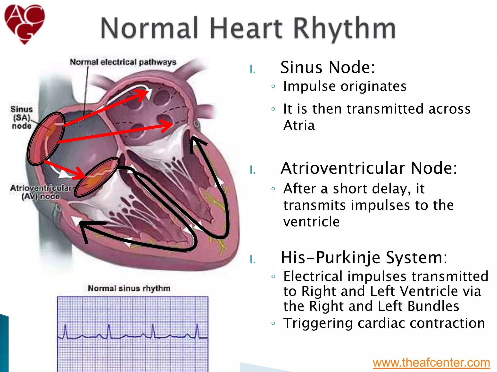 What is atrial fibrillation? | PPTX