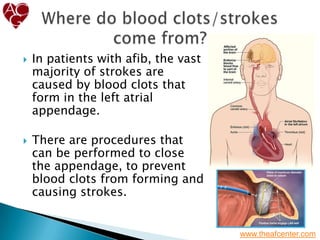 What is atrial fibrillation? | PPTX