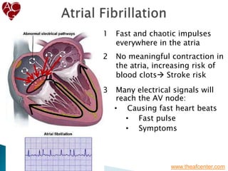 What is atrial fibrillation? | PPTX