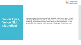 What Are Four Warning Sign of Damaged Liver | PPT