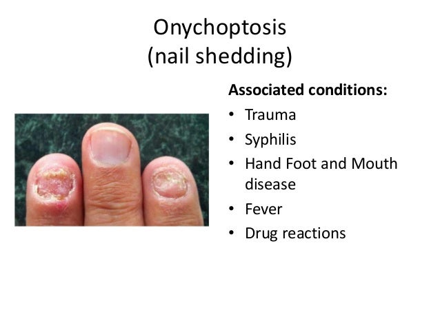 A Pictoral Ddx for Nail Health