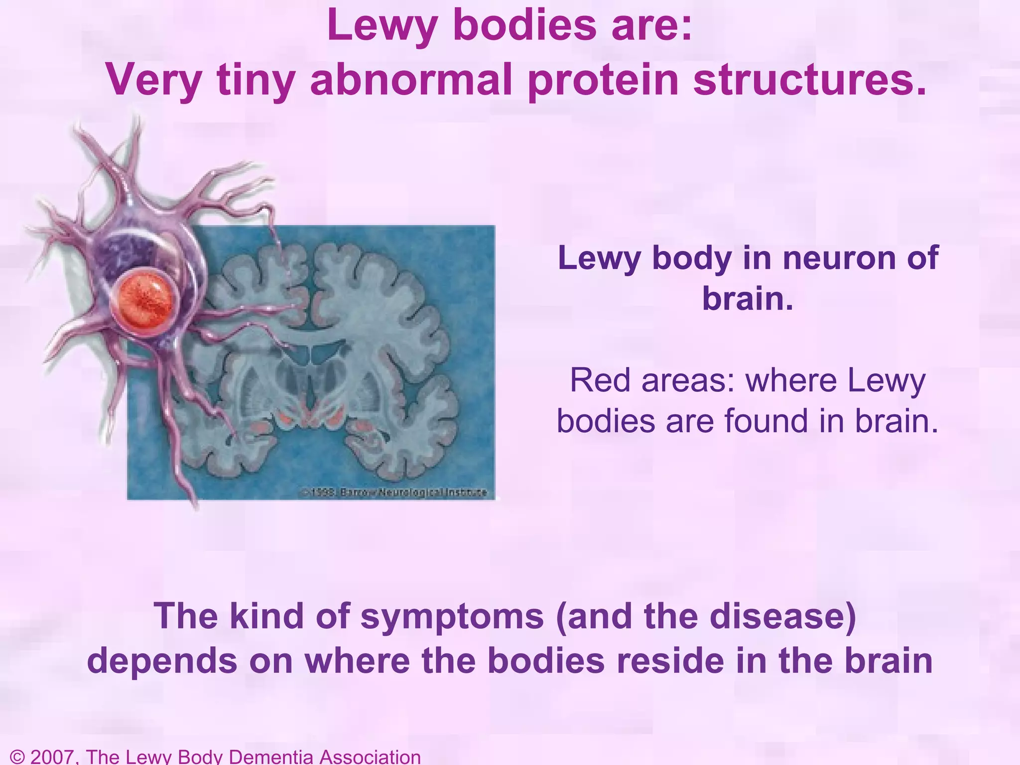 What Is Lewy Body Dementia | PPT
