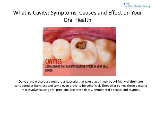 What is-cavity-symptoms-causes-and-effect-your-oral-health