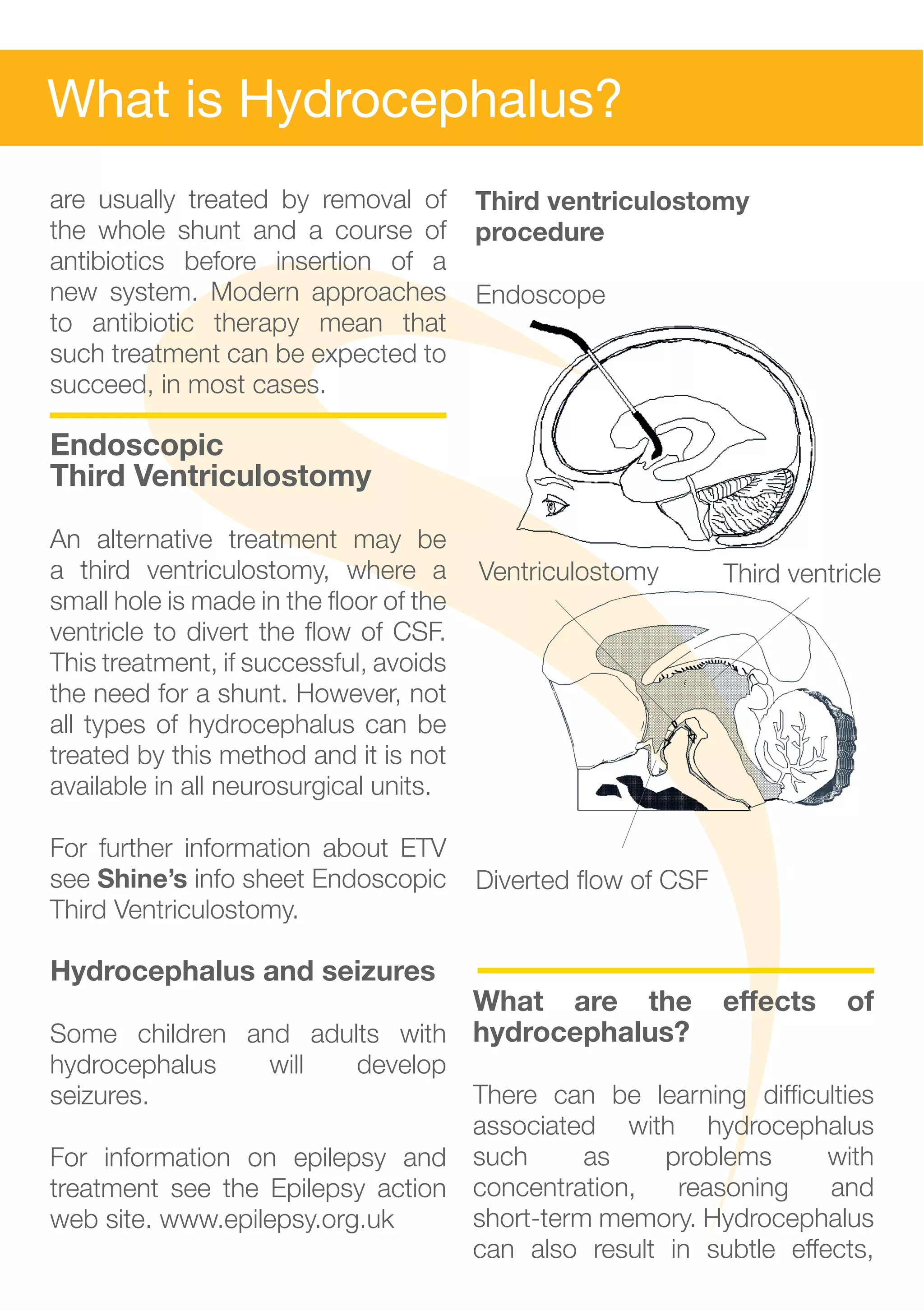 What is Hydrocephalus? | PDF