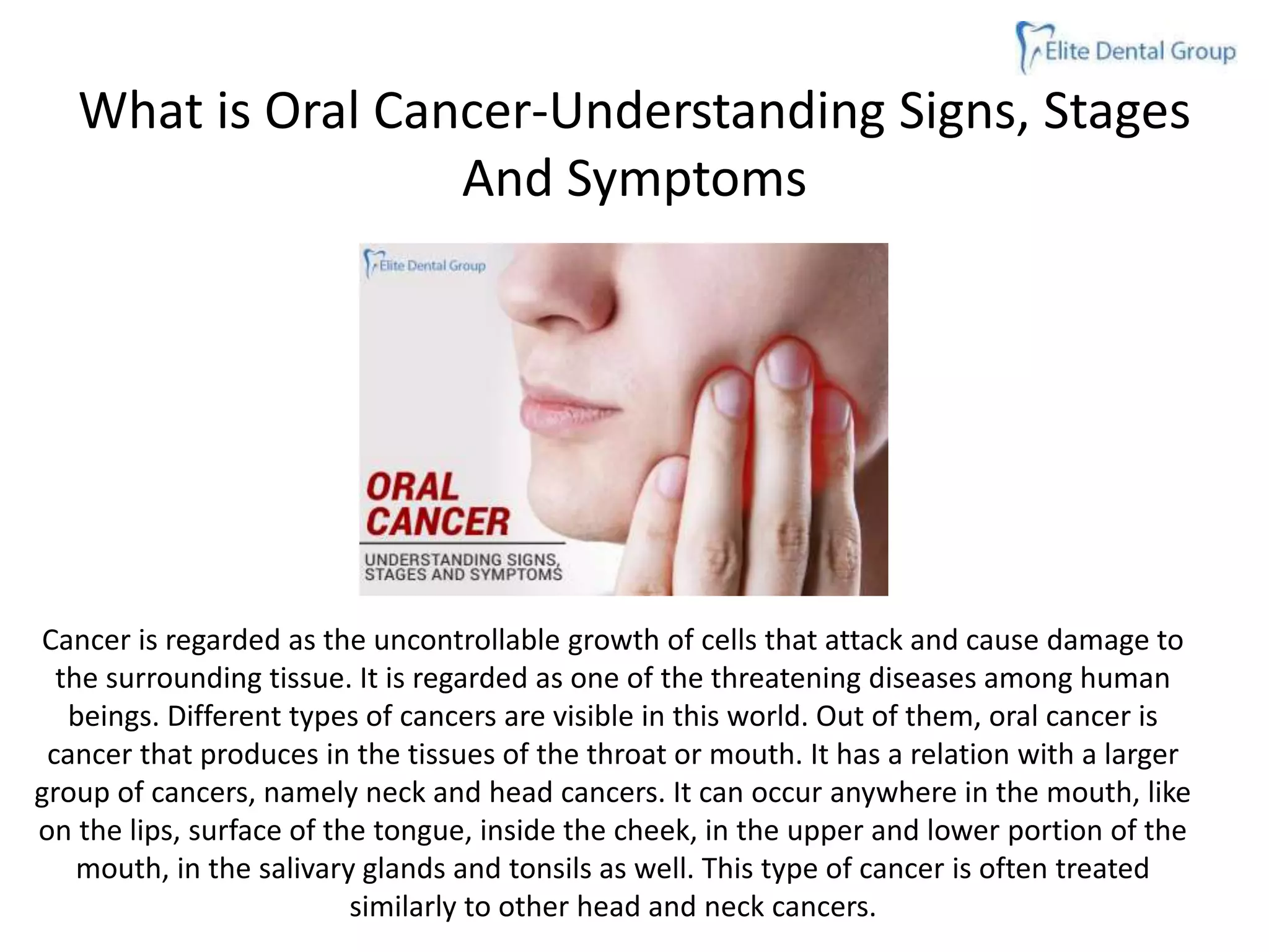 WHAT IS ORAL CANCER-UNDERSTANDING SIGNS, STAGES AND SYMPTOMS | PPTX