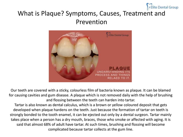 WHAT IS PLAQUE? SYMPTOMS, CAUSES, TREATMENT AND PREVENTION | PPTX