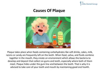 WHAT IS PLAQUE? SYMPTOMS, CAUSES, TREATMENT AND PREVENTION | PPTX