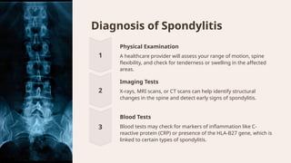 What is Spondylitis : introduction and overview | PPTX