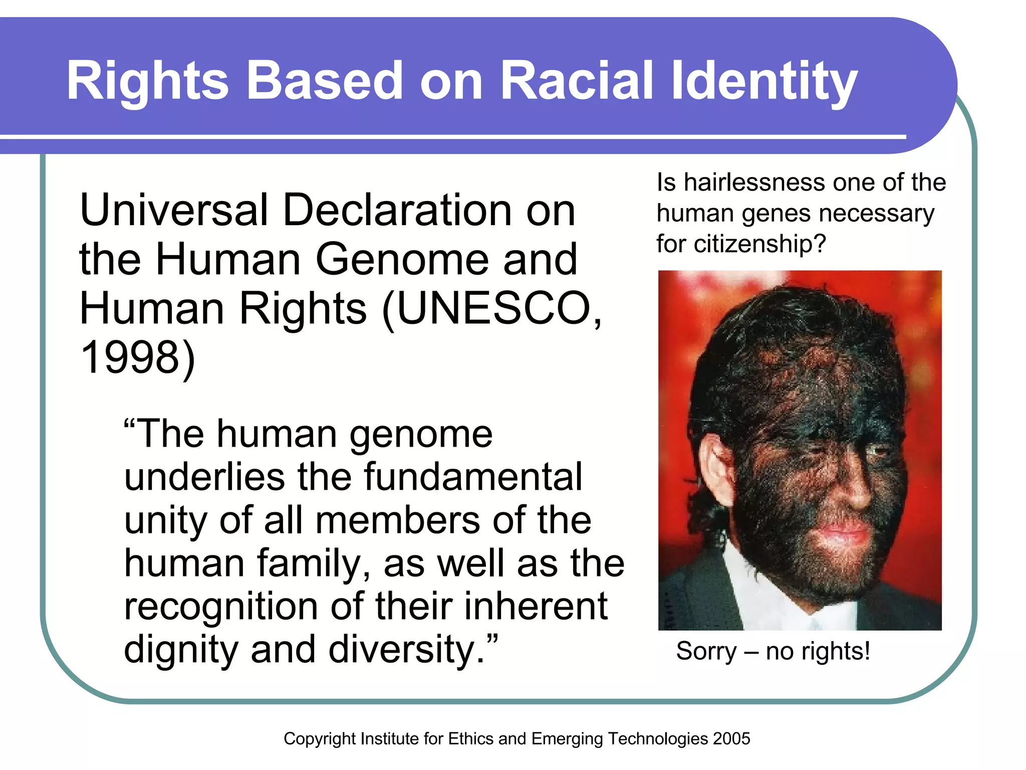 What is Transhumanism | PPT