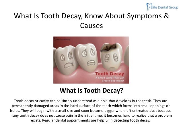 What tooth-decay-know-about-symptoms-causes