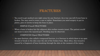 What are fractures | PPTX